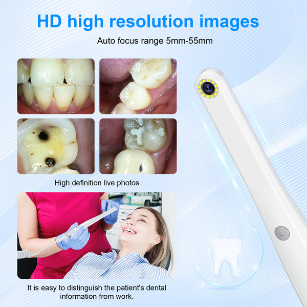 PD750 Intraoral Camera ProDENT